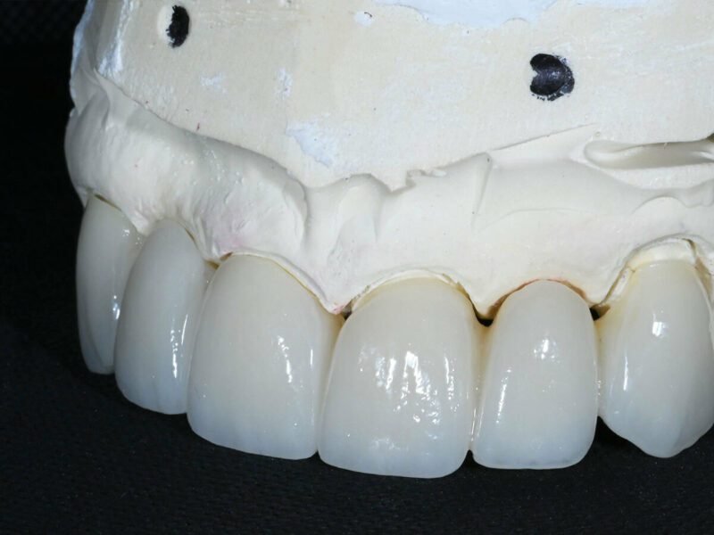 Post-Op Instructions - Barry Road Dental Group